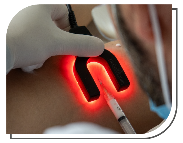 Especialista en Várices en Querétaro Escleroterapia